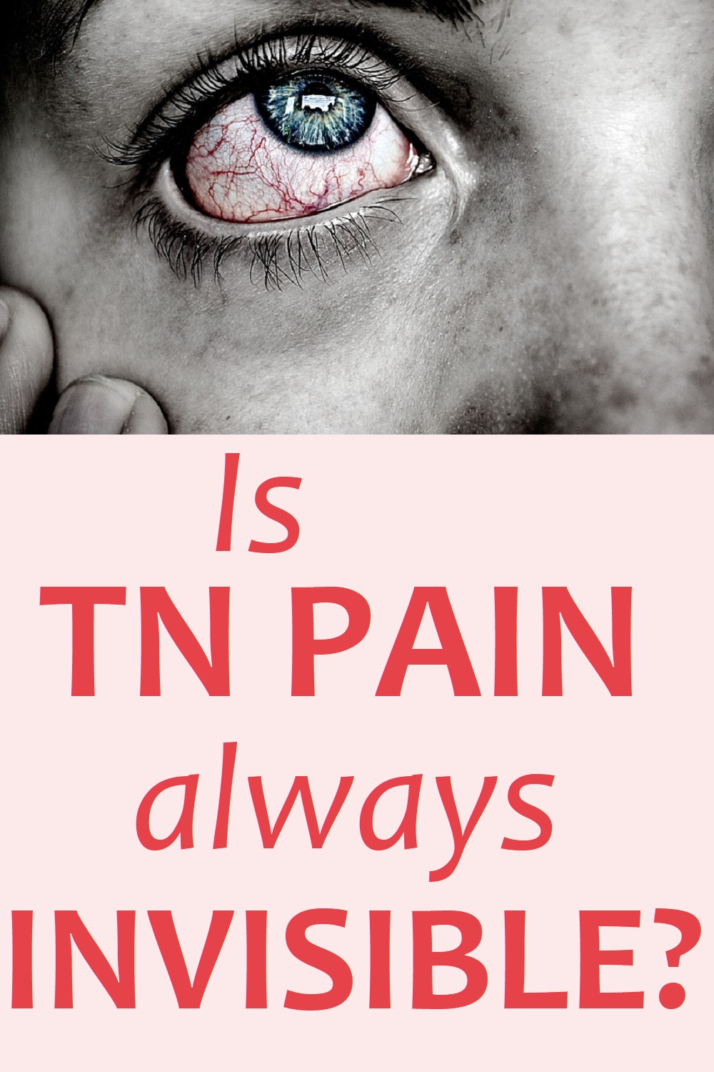 Is your TN pain really so invisible? – Verve